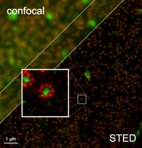 The power of STED microscopy, Part 1: How does it work?