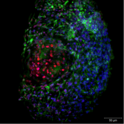 Live-Cell Imaging: Choosing the Right Technique