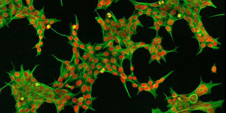 Controls for Immunofluorescence: A Beginner’s Guide