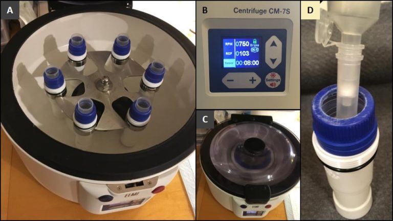 Diy Centrifugation Based Purification Of Cfdna