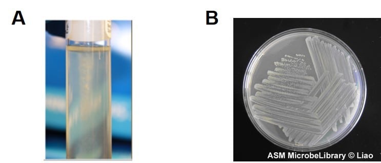 How to Preserve Microorganisms: the long (and short) game