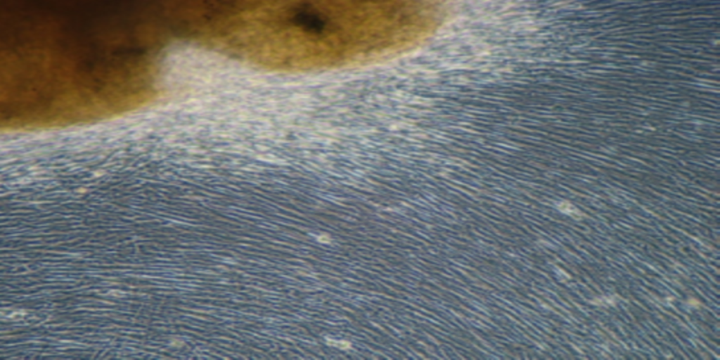 The What, Why and How of Explant Culture