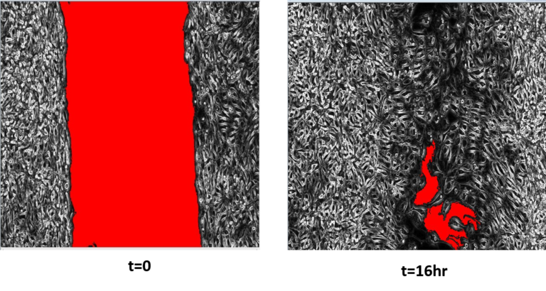 Imaging and Analyzing Your Wound Healing Assay