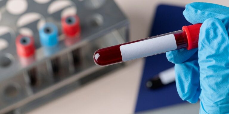 Blood Collection Tubes: the Right Choice for Your Experiment
