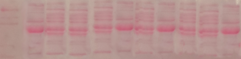 Ponceau S Staining: Easy Guide to Fix 7 Western Blot Issues
