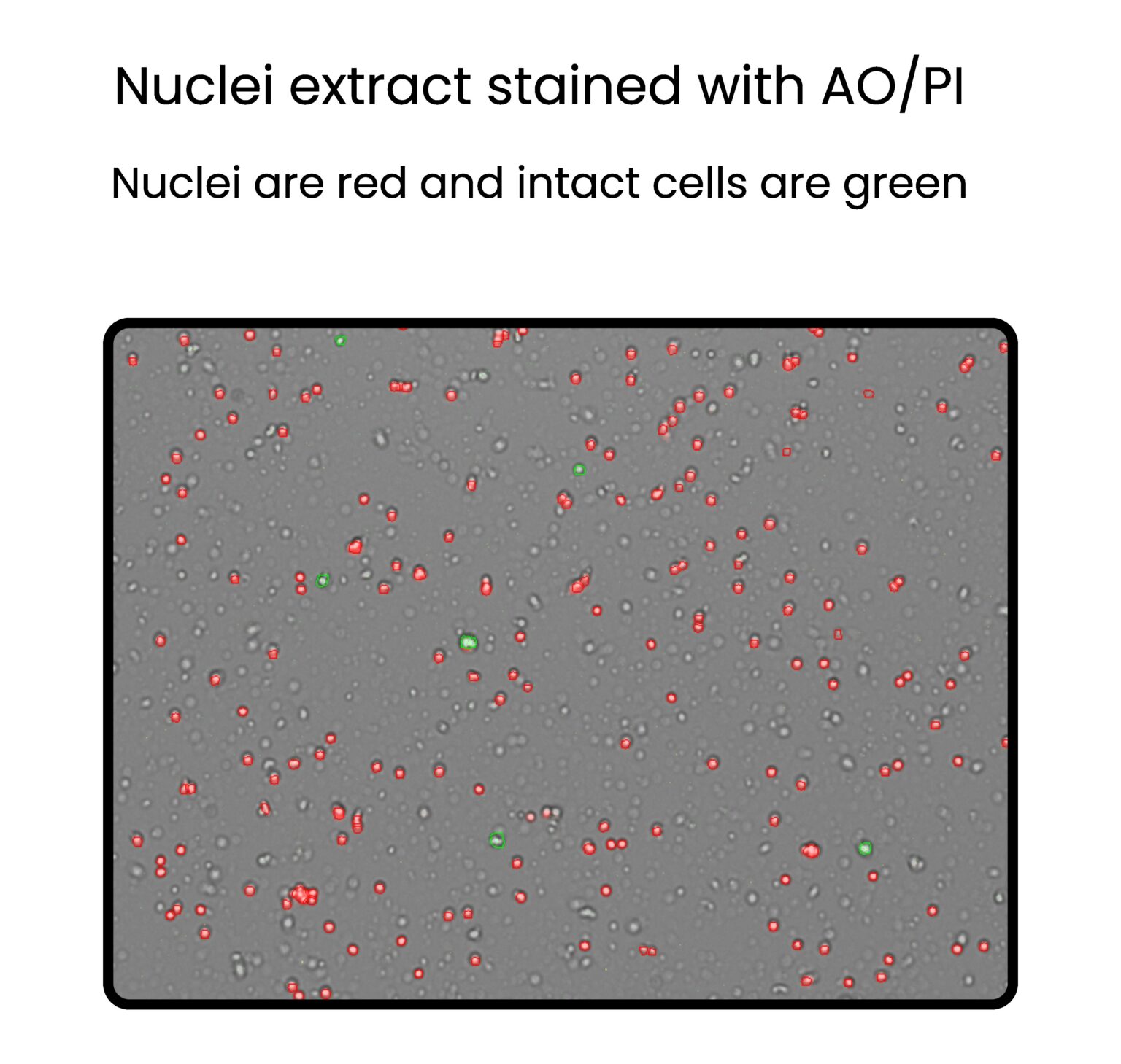 Top Tips for optimizing nuclei extraction and counting